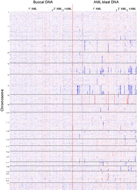 Whole Genome Copy Number Heatmap Display Of 114 Aml Genomes Copy
