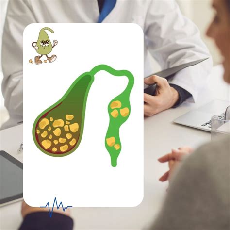 Gallbladder Calculus And Acute Cholecystitis Symptoms And Treatment Iaas Med