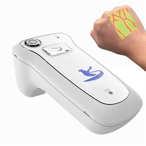 5 Best Vein Finder