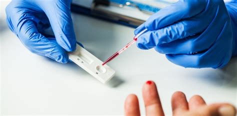 What Is A Serological Test Quiz Flashcards Trivia