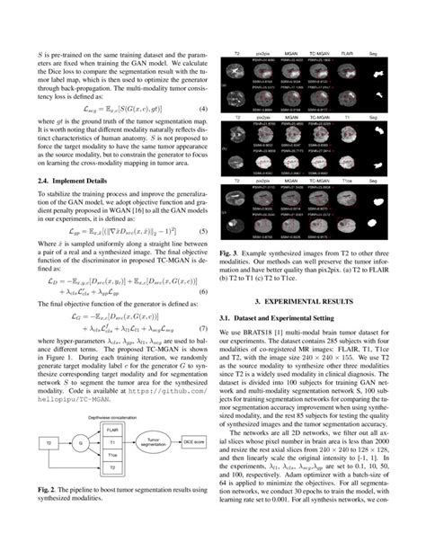 Multi Modality Generative Adversarial Networks With Tumor Consistency