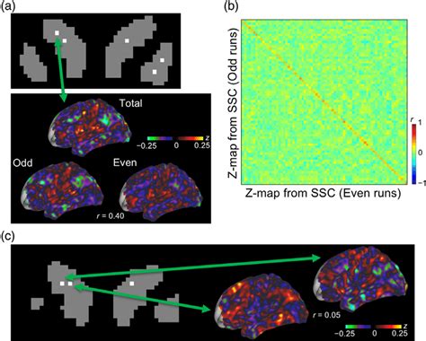 Connectivity Of The Striatal Subdivisions With The Cerebral Cortex A