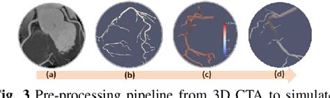 Figure 3 From Ai Based Agents For Automated Robotic Endovascular