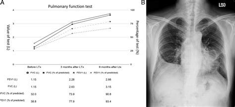 A Pulmonary Function Test Result B Chest Radiograph After Five Download Scientific Diagram