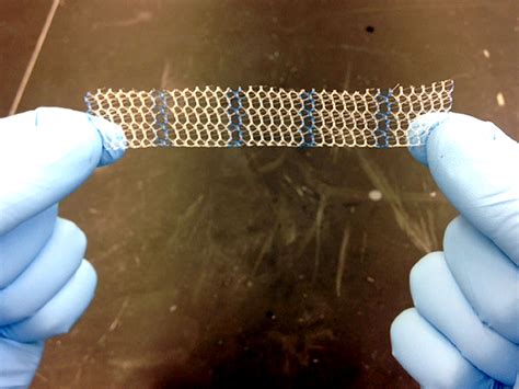 Scientists Develop Alternative Material For Mesh Implants The Sunday Post