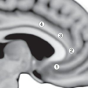 PDF Regionally Specific Alterations In Functional Connectivity Of The Anterior Cingulate