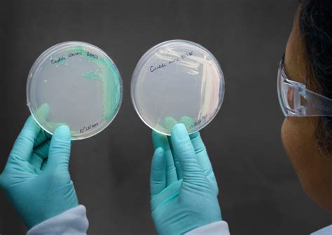 C Auris A Dangerous Fungus If You Re Immune System Is Compromised The MS Wire