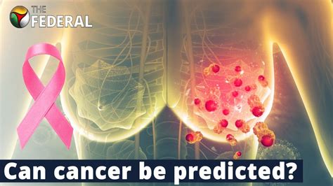 Artificial Intelligence Tool To Identify Cancer Causing Genes Iit Madras