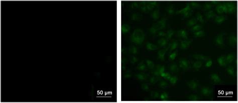 An Overview Of Schiff Base Based Fluorescent Turn On Probes A Potential Candidate For Tracking