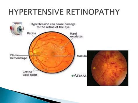 Fundoscopy Ppt 2012 Pptx
