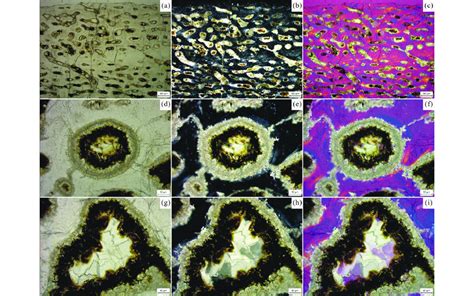 Bone Microstructure In Juvenile Sxmg V00089 A C The Outer Cortex Under Download Scientific