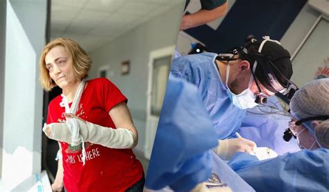 Новини Львова хірурги прооперували жінку з рідкісною вадою рук