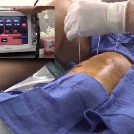 Pain Relief Spine Center Pain Management Doctor Clinic Los Angeles