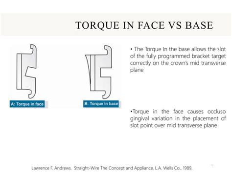 TORQUE IN ORTHODONTICS Short PPT Basic PPTX