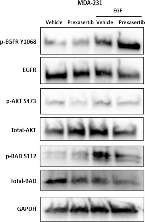 Egfr Signaling Promotes Resistance To Chk1 Inhibitor Prexasertib In