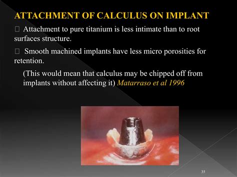 Calculus Classification Composition Microbiology Etcpptx