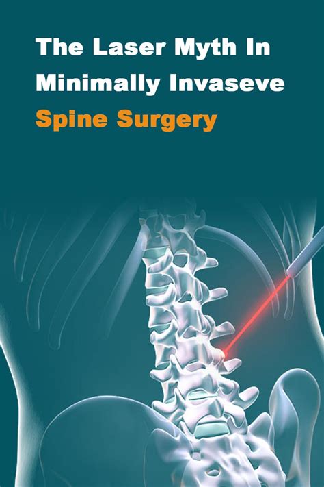 Laser Spine Surgery Potent Medical