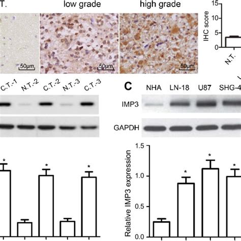 Imp3 Expression In Glioma Tissues And Cells A Representative Ihc