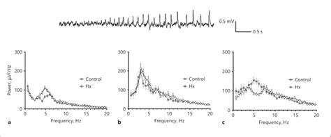 Electrocorticographic Ecog Power Spectrum Density Of 4 Aminopyridine Download Scientific