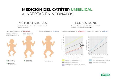 Medición Del Catéter Umbilical A Insertar En Neonatos