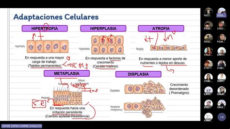 Atrofia Celular