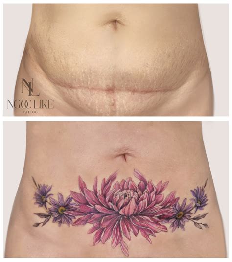 C Section Scar Tattoo