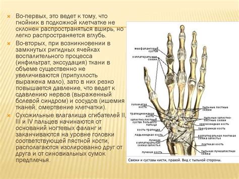 Анатомические особенности кисти - презентация онлайн
