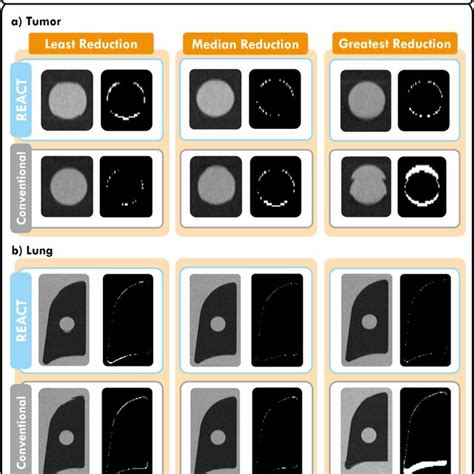raw ct images and corresponding difference to the ground truth for a download scientific