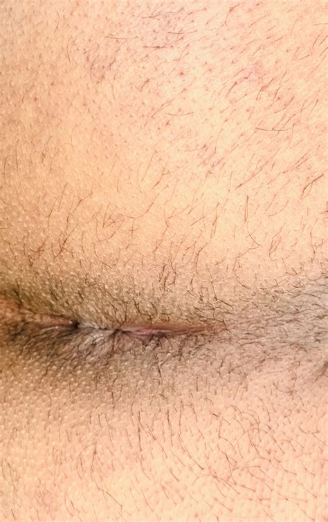 Close Up Asshole 9 Pics XHamster