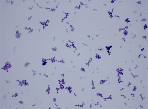 Yeast Fungi Slide Fungal Tests Pathology Tests Explained