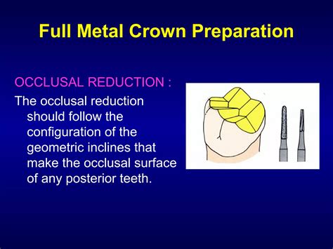 Prin Of Tooth Prep Ppt