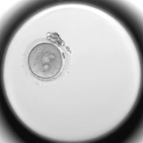 Early Embryo Development