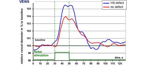 Is Showing The RVA Results For The Veins Of Both Hemispheres HS Defect Download Scientific