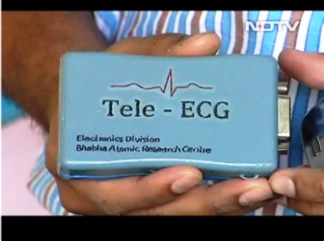 Low Cost Ecg Monitoring Device Developed By Baba Atomic Research Centre