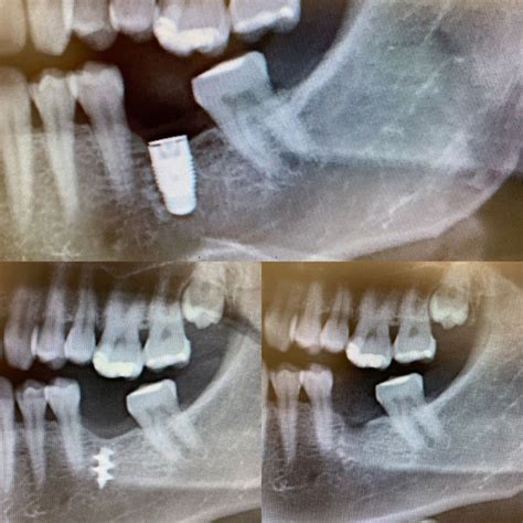 Dr Marco Cardinali On Linkedin Problem Solved 😉