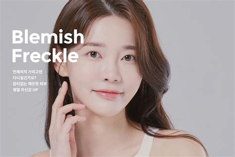 기미 주근깨 검버섯 강남뷰티성형외과