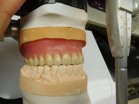 Efficiency And Accuracy In Denture Base Processing Keystone Industries