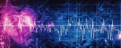 An Ekg Graph With Abnormal Readings Next To A Healthy Heart Image Visualizing Arrhythmia