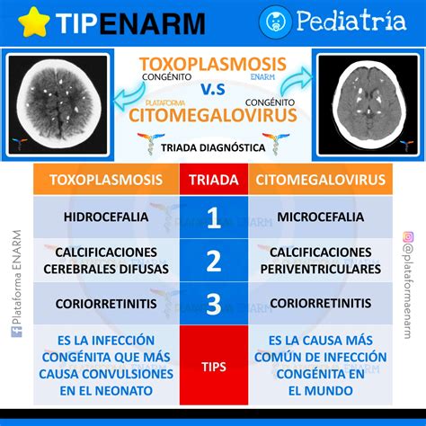 Toxoplasmosis Vs Citomegalovirus 🧠 Plataforma Enarm