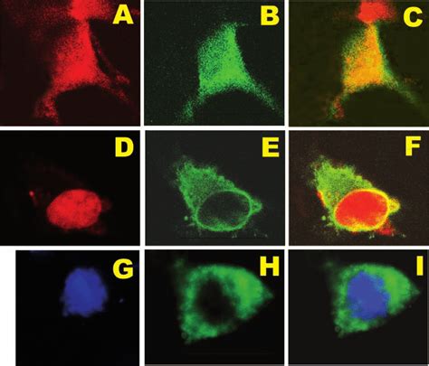 Intracellular Localization Of Cpges Gfp Flagmpges 1 And Mpges 2 Gfp