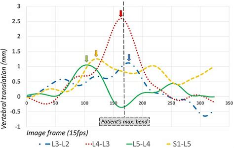 Example Of Continuous Translational Motion From L S In A Healthy Download Scientific Diagram