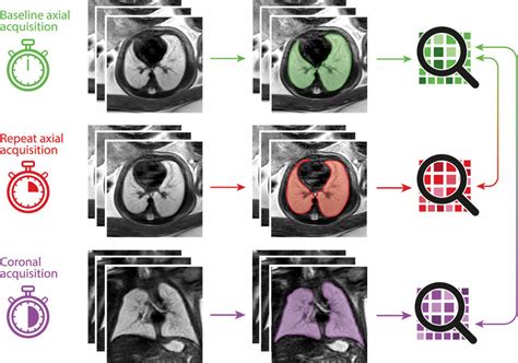 graphical summary illustrating the segmentation and feature extraction