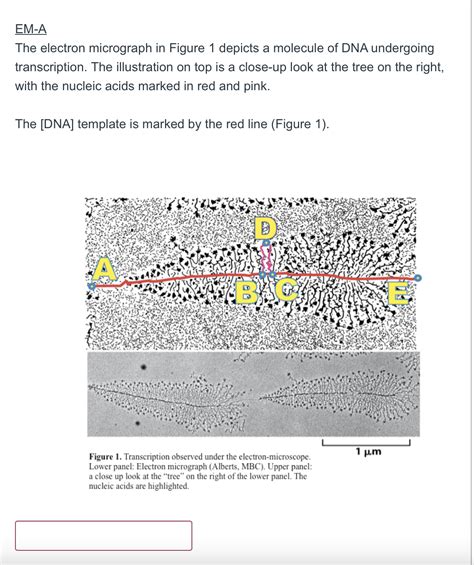Solved EM A The Electron Micrograph In Figure Depicts A Chegg
