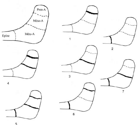 Les Trois Centres D Ossification De L Acromion Méta A