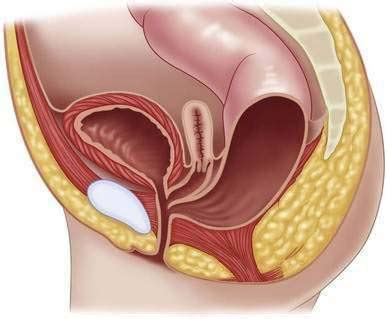 Rio Jewel Cloaca Anatomy