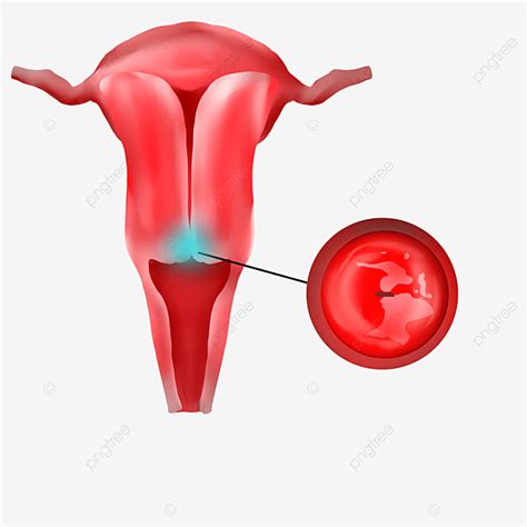 신체 기관 자궁 일러스트 질환 신체 기관 인체기관 자궁 Png 일러스트 및 Psd 이미지 무료 다운로드 Pngtree