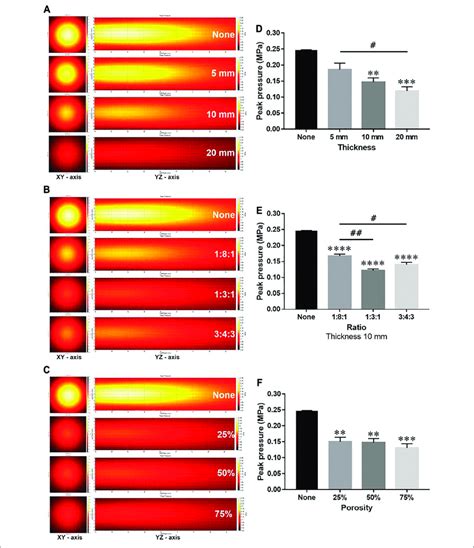 Comparison Of Ultrasound Energy Attenuation Rates According To Skull Download Scientific