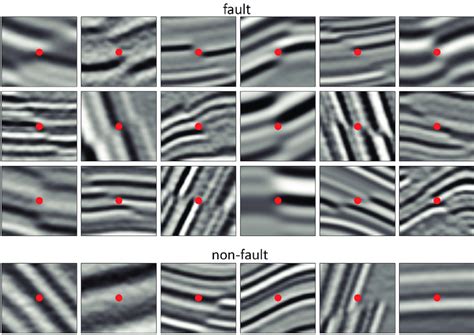 2d Slice Examples Extracted From 3d Synthetic Training Data Top Three
