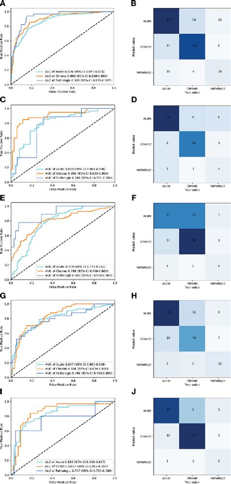 Figure 2 From Deep Learning Based Artificial Intelligence Model For Classification Of Vertebral