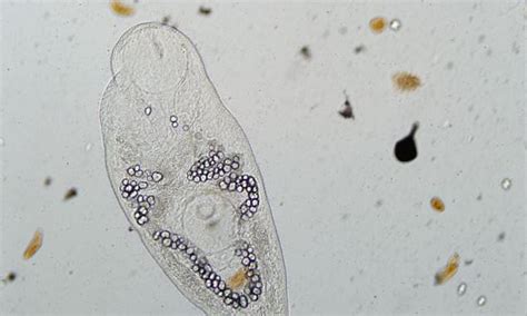 Conservationists Urge To Save The Parasites Before They Go Extinct